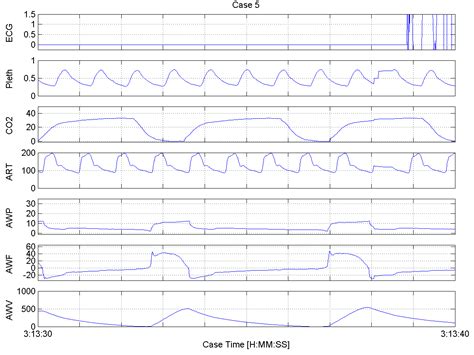 Case 5 Waveform Plots 10 Second Plots