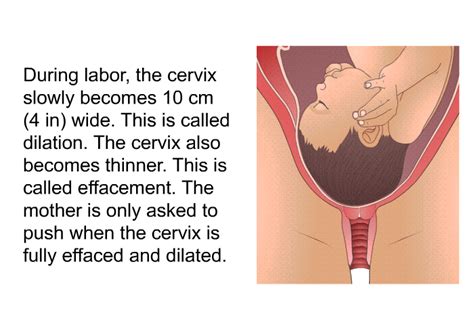 Cervix During Labor