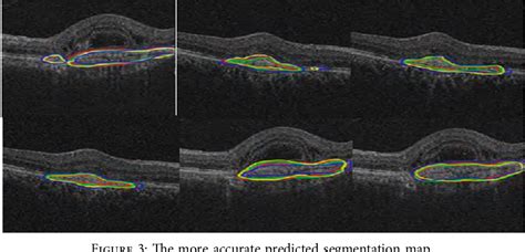 Figure 1 From Design And Implementation Of Obstetric Central Monitoring System Based On Medical