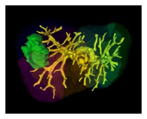 Three Dimensional Visualization Of Liver Download Scientific Diagram
