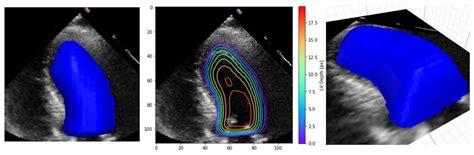 explainability of deep learning models in medical video analysis a