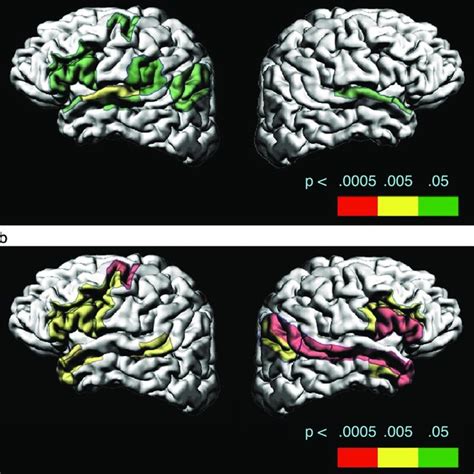 A Cortical Areas Displaying Activation For Audio Visual English Download Scientific Diagram
