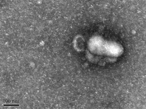 Detection Of Extracellular Vesicles A Representative Tem Image Of