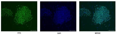 Cell Fate Commitment And The Waddington Landscape Model Proteintech Group 武汉三鹰生物技术有限公司