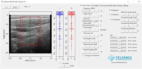research beamformed rf data telemed ultrasound