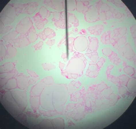 Lab Practical 1 Tissue Slides Flashcards Quizlet