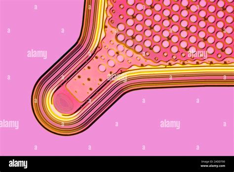 Light Micrograph Of A MEMS MicroElectroMechanical System Microphone Wafer MEMS Microphones