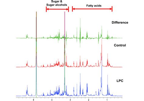 1h Nmr Metabolite Profile Spectrum Of Wild Type Arabidopsis Plants Download Scientific Diagram