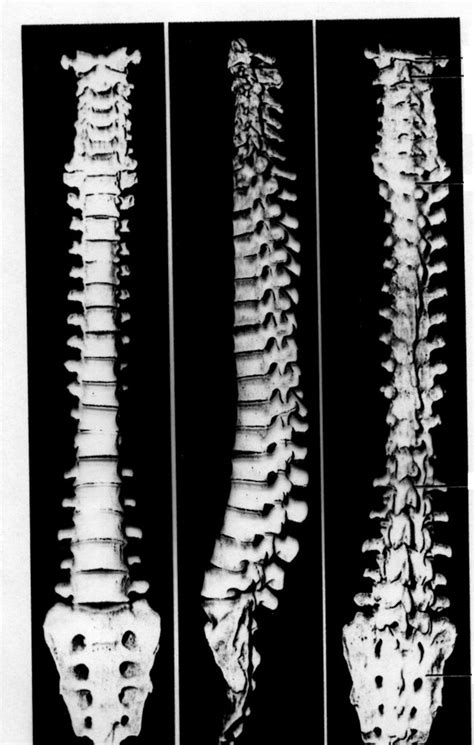 Spinal Column Views Diagram Quizlet