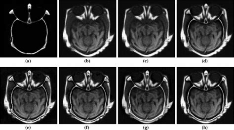 image set 1 a ct input b mri input c bfif [22] d ffif [18] e gfsf [19