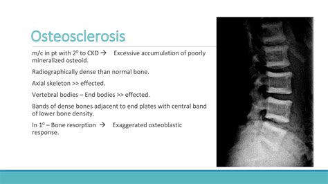 Hyperparathyroidism Imaging Metabolic Bone Disease Pptx