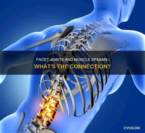 Facet Joints And Muscle Spasms Whats The Connection Cyvigor