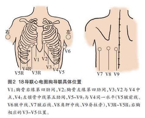 十八導聯心電圖的重要臨床意義 每日頭條