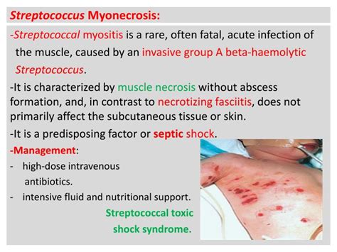 Ppt Infectious Myositis Powerpoint Presentation Id 1865298