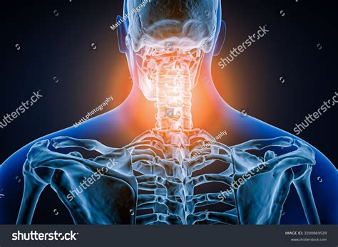 Posterior Back View Human Spine Spinal Stock Illustration 2200869529 Shutterstock