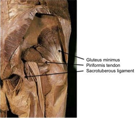 Sacrospinous Ligament Cadaver