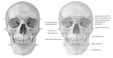 Craniometric Frontal Points And Measurements Kaitlin Lindsay