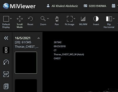 DICOM Viewer Imaging Projects Photos Videos Logos Illustrations And Branding On Behance