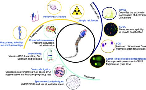 Sperm Dna Fragmentation Art Assisted Reproductive Technology Imsi