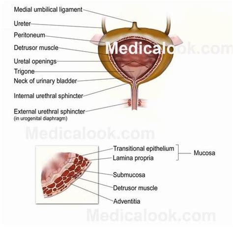 Chronic Cystitis Artofit