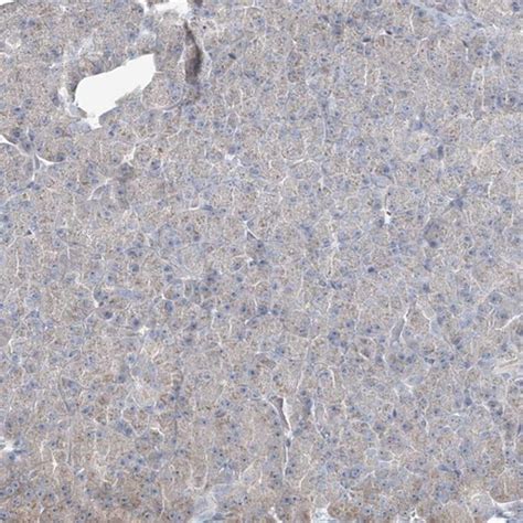 Rabbit Polyclonal Anti Cxxc5 Antibody Buy For Research Highly Specific Rigorously Validated