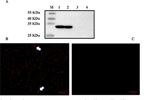Figure 1 From Oral Delivery Lactococcus Lactis Expressing Cherry Fusion Lactoferrin Peptides