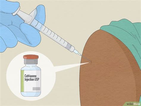 How To Know If You Have Epididymitis Symptoms Causes