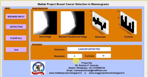 Breast Cancer Detection In Mammograms Matlab Project With Source Code