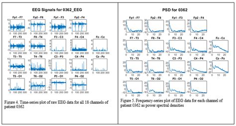 A Deep Dive Into EEG Analysis For Predicting Neurological Outcomes Student Lounge MATLAB
