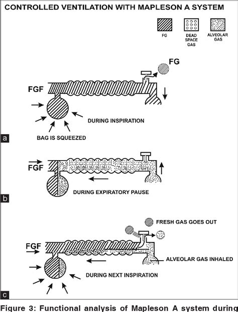 Figure 6 From Mapleson S Breathing Systems Semantic Scholar
