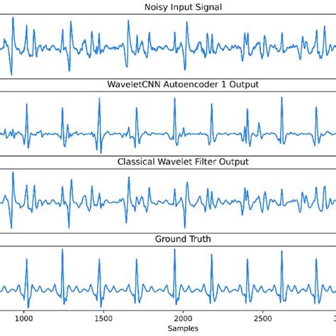 Machine Learning Pipeline For Detecting Qrs Complexes Download