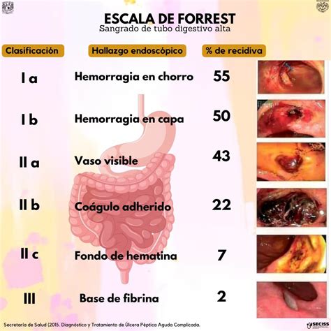 La Clasificación De Forrest Es Usada Para Clasificar Y Distinguir Las Características