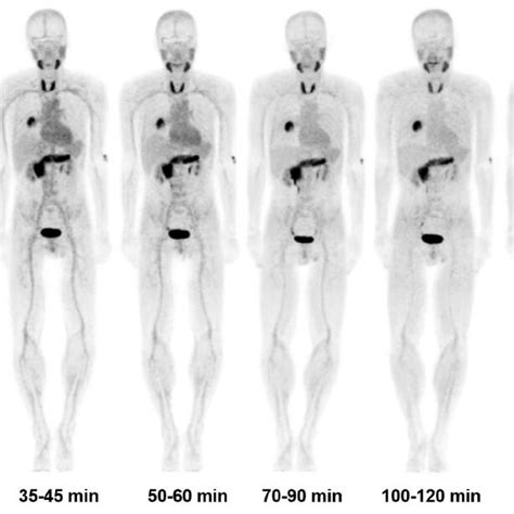 The Average 3 H Time Activity Curves Tacs From 9 Participants Of 68