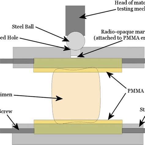 A Micro‐computed Tomography Scan Showing The Injected Volume Of Cement