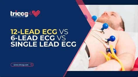 12 Lead Ecg Vs Single Lead Ecg The Superior Choice