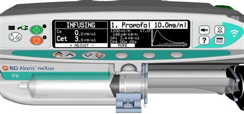 Target Controlled Anaesthesia Where Its Going And Why Hospital