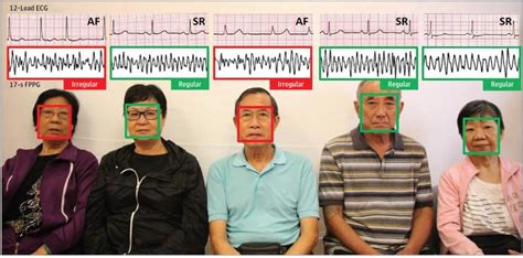 Eric Topol Md On Linkedin Ai Jama 52 Comments