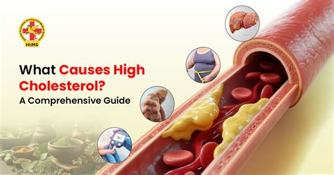 What Causes High Cholesterol Complete Guide
