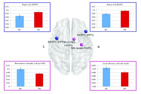 Sensorimotor And Fronto Parietal Nodes Showing Group Differences