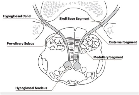 Cisternal Segment Of Hypoglossal Nerve Entrance Point From The