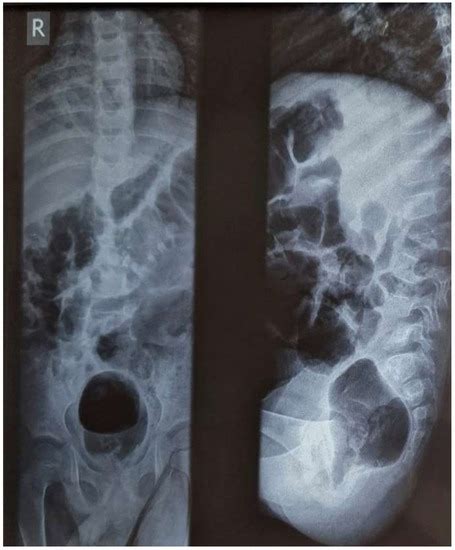 Pathogens Special Issue Current Research On Tuberculosis Prevention