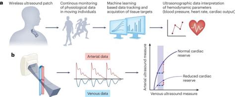 Wearable Ultrasound For Continuous Deep Tissue Monitoring Nature Biotechnology Muyang Lin