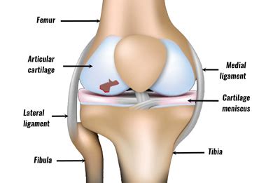 Articular Cartilage Injury Symptoms Causes Treatment