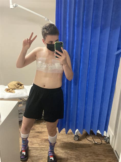 How Long Did You Wait To Have Sex After Top Surgery R TopSurgery