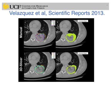 Lec14 Evaluation Framework For Medical Image Segmentation Ppt