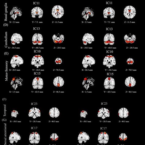 Two Sample Results Resting State Networks Between Control And Adhd