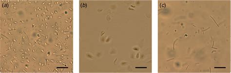 Microscope Observations During Differential Lysis Procedure A Download Scientific Diagram