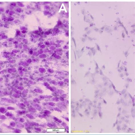 A Representative Example Of A 200x Final Magnification Field