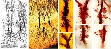 Complex Dendritic Spines Thorny Excrescences Of Ca3 Pyramidal