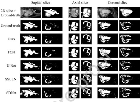 qualitative segmentation results of our method and four advanced